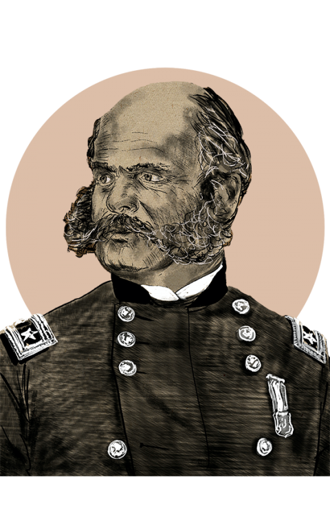 Electrolysis for Sideburns - Electrolysis by Alison